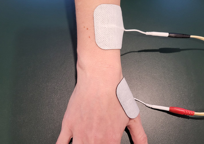 Thumb Pain Treatment Oakville - Physiotherapy & Shockwave