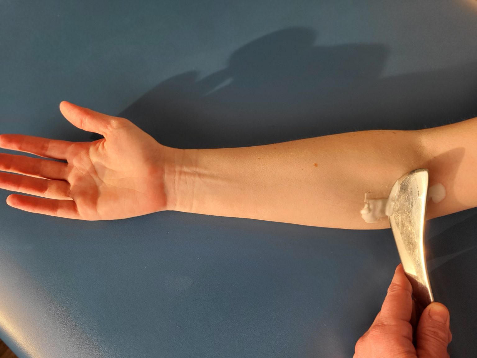 Best Golfer's Elbow Treatment Oakville – Book Now